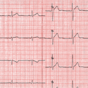 Harley Street Physicians – Dr Milton Maltz – GP, Cardiology and Health ...